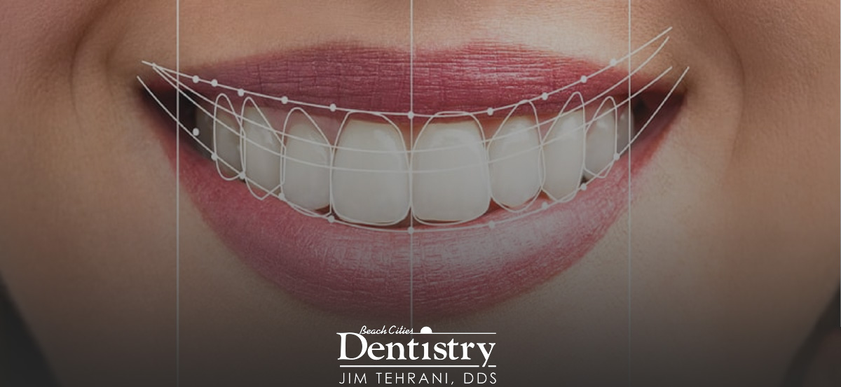 Cosmetic Dentistry Methods | Beach Cities Dentistry