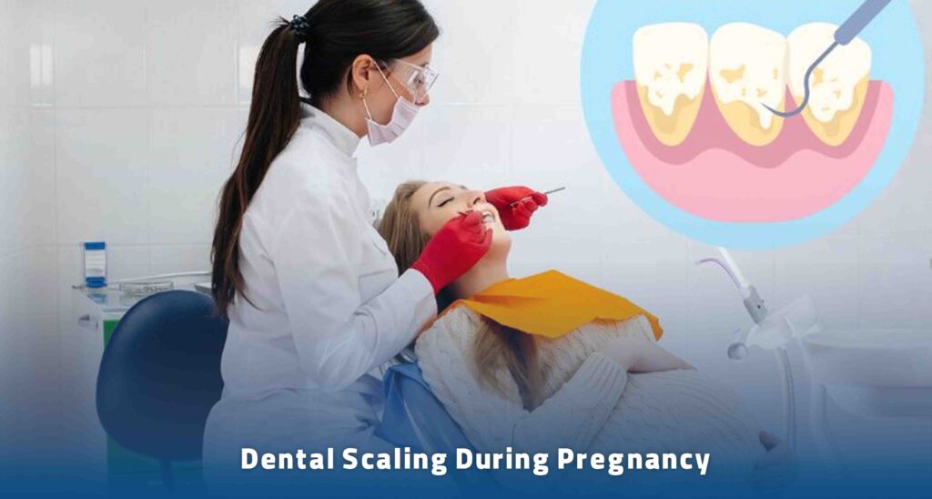 The Complete Guide to Dental Scaling