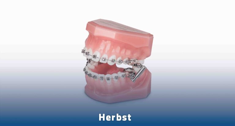 Orthodontic Terminology | 40+ Essential Words Defined